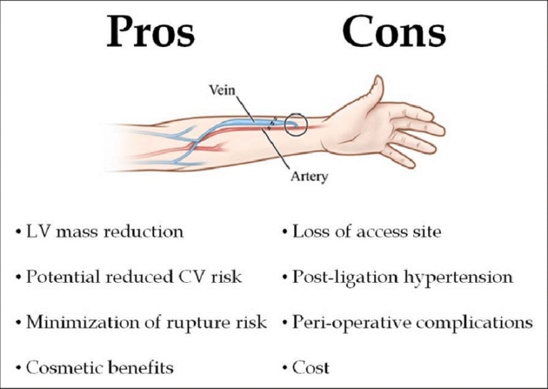 Why you need an AV fistula for dialysis? - Dr. Jathin's Vein Center