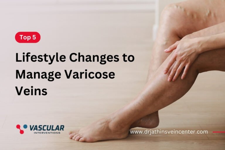 Top 5 Lifestyle Changes to Manage Varicose Veins - Dr. Jathin's Vein Center