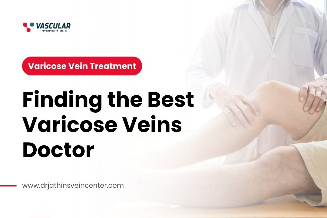Finding the Best Varicose Veins Doctor: Your Guide to Comprehensive ...