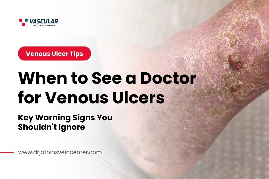When to See a Doctor for Venous Ulcers: Key Warning Signs You Shouldn't ...